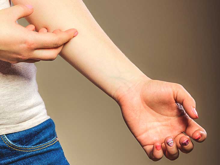 What is occupational dermatitis?